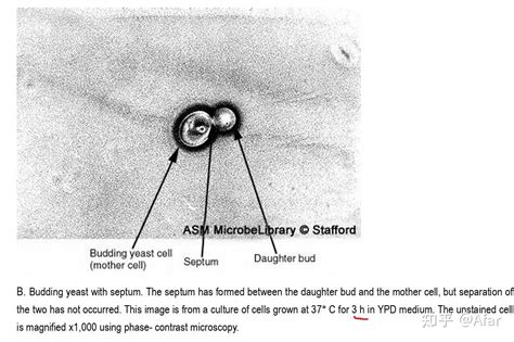 细胞培养中的真菌污染 知乎