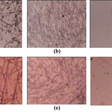 Synthesis Steps Of Functionalized Imidazolium Based Ionic Liquids Download Scientific Diagram