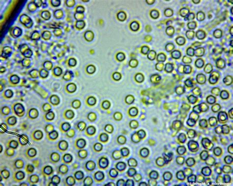 Trichoderma Under The Microscope 1000x Rmycology