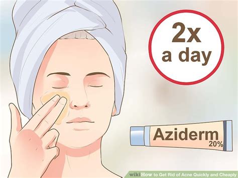 3 Ways To Get Rid Of Acne Quickly And Cheaply WikiHow Life