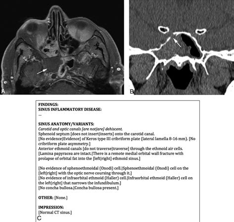 Radiographic Report Template Chest X Ray Interpretation A Structured