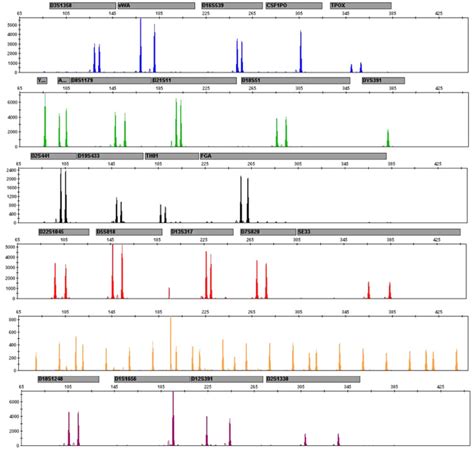 Teaching Artificial Intelligence To Read Electropherograms Forensic Science International