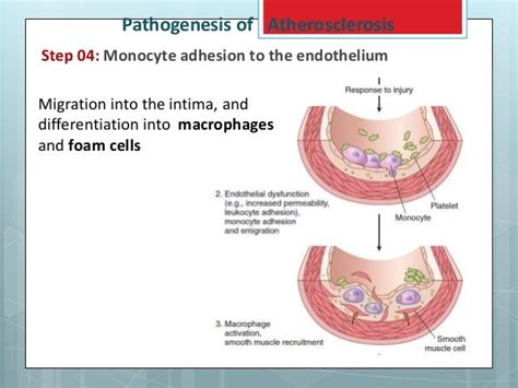 Lipid Metabolism And Atherosclerosis A Brief Review