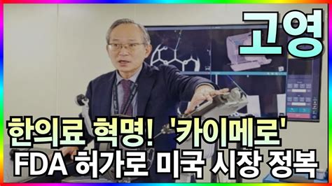 고영 주가전망 속보 Fda 뇌수술 로봇 승인에 주가 3 상승의료 Ai 시장 선점 기대 고영전망 고영 고영주가전망
