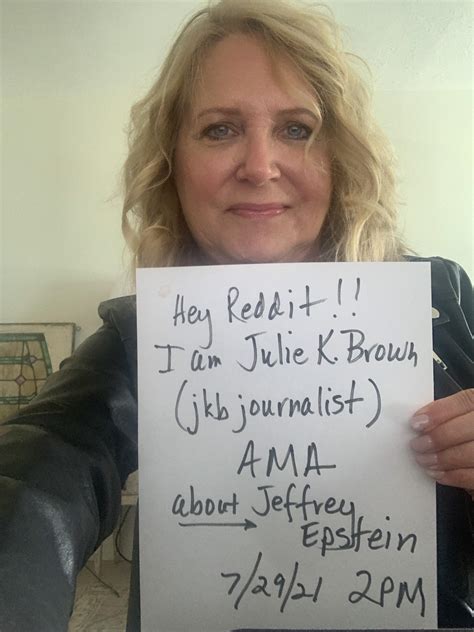 I Ama A 75 Year Old Acromegaly Gigantism Patient Who Went Undiagnosed