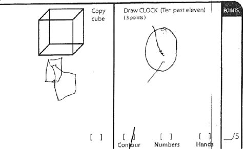 Moca Scoring Nuances With Clock Draw ~ How To Flunk Those Cognitive