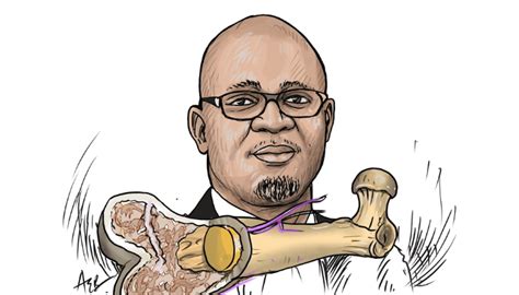 Nigerians Dont Need To Go Abroad For Bone Marrow Transplant Luth Cmd Businessday Ng
