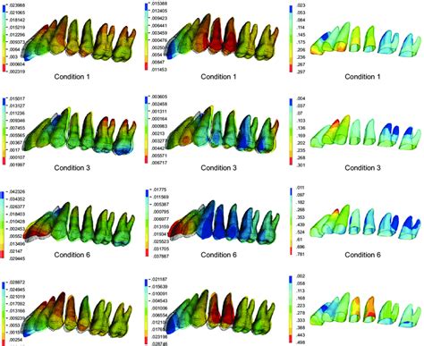 Contour Plots A Distal Displacement Mm B Vertical Displacement