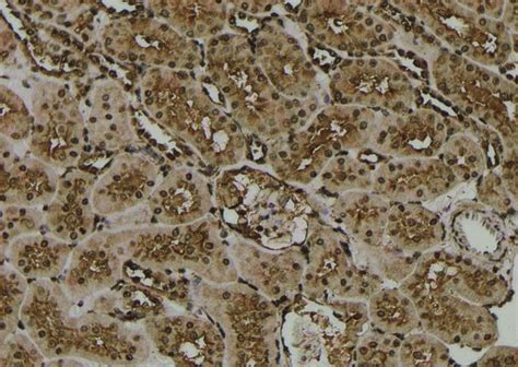 Phospho Pka Alphabeta Thr197 Polyclonal Antibody Invitrogen 100 μl