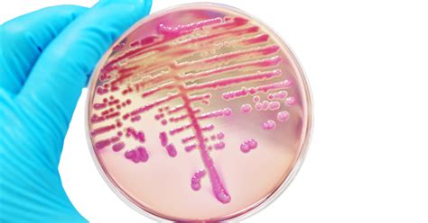 Cosè L Escherichia Coli Nelle Urine Torrinomedica