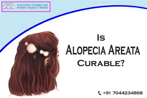 Scarring Alopecia Vs Non Scarring 7 Key Differences