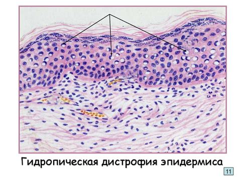 Содержание и задачи патологической анатомии Дистрофии Лекция 01