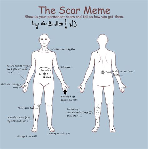 Scar Meme By Igobrullen On Deviantart