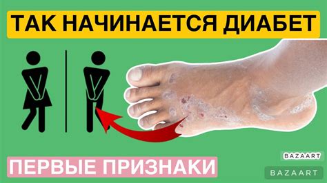 Еще нет диабета но … есть 16 признаков высокого сахара Youtube