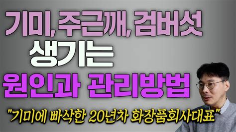 20년간 고생하며 찾은 기미 주근깨 검버섯 예방 And 없애는 방법 Youtube