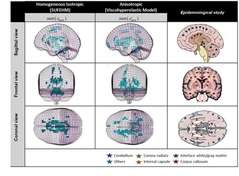Location Of The 100 Elements With Maximal Axonal Strain Values For Two