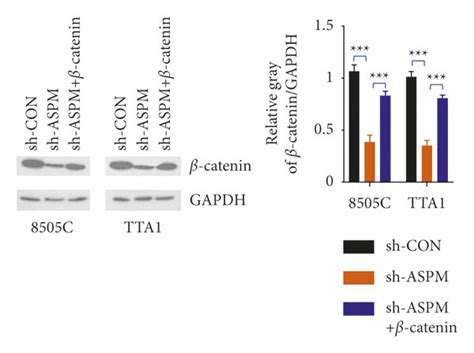 Aspm Regulates The Wnt β Catenin Signaling Pathway In Atc Cells A Download Scientific
