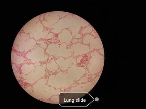 Medical Stuff Histology Slides Of Respiratory Track