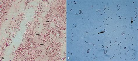 Campylobacter Arcobacter And Helicobacter Basicmedical Key