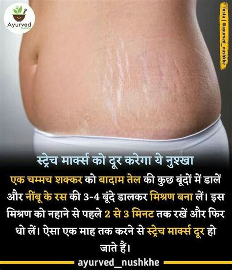 Pin By Tanu Ansari On Achchi Bate Homemade Skin Care Recipes Good