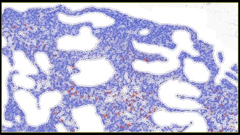 Positive Dab Cell Selection On Multiple Images In Qupath Image Analysis Imagesc Forum