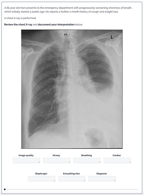 Radiology Case Collection 130 Cases Geeky Medics