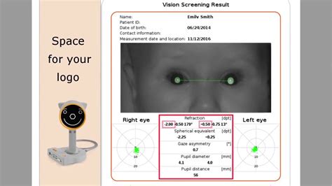 Plusoptix S16 Documenting The Measurement Results Youtube