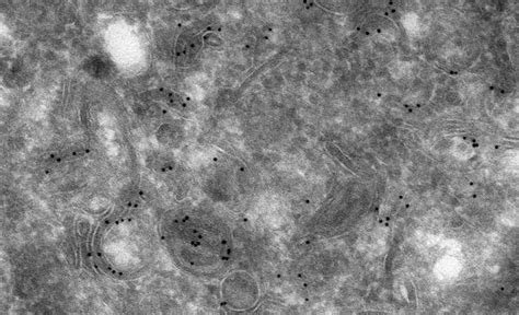 Immuno Transmission Electron Microscopy Immuno Tem Creative Bioarray