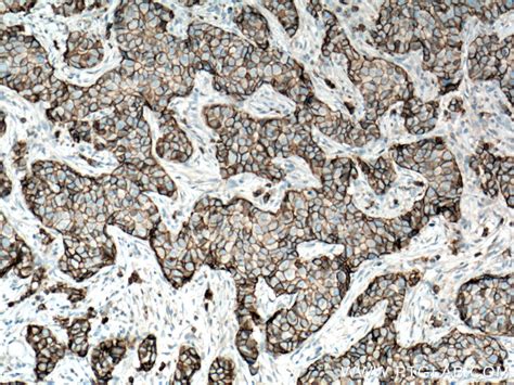 E Cadherin Antibody 20874 1 Ap Proteintech