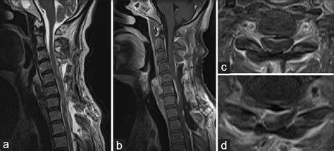 Surgical Neurology International