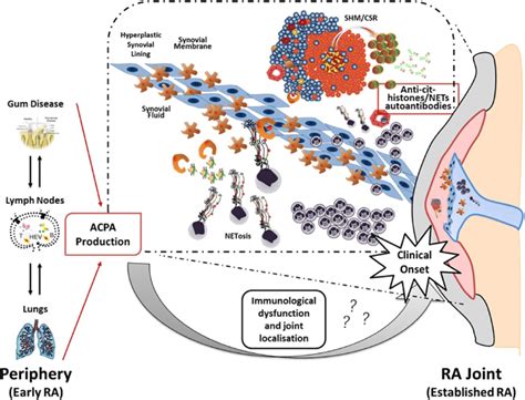 Neutrophil Netosis And Anti Net Antibodies In Synovial Els A New Download Scientific Diagram
