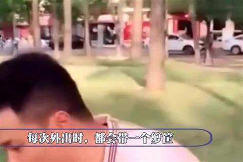 成都出现一对连体男女他们相依为命看到让人羡慕