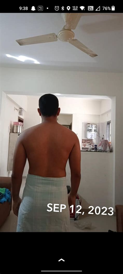 Neck Slightly Tilted To Left Side Radvancedposture