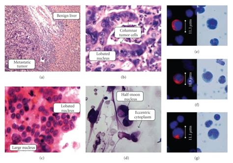 Differences Between Histology And Cytology Compare The Difference