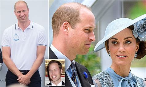 How Prince Williams Baldness Caused A Crisis For Royal Mint Chiefs