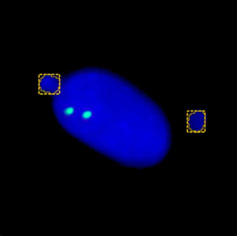 Apeer Blog Advanced Image Analysis