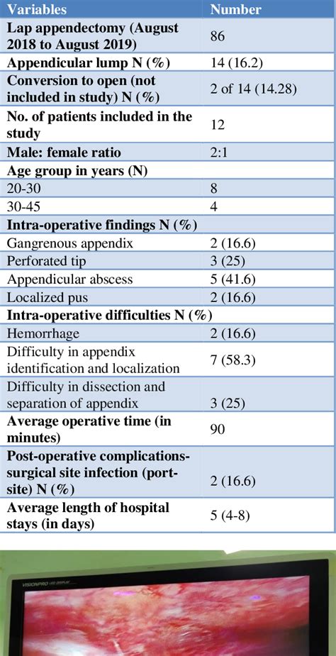 Laparoscopic Management Of Appendicular Lump Semantic Scholar