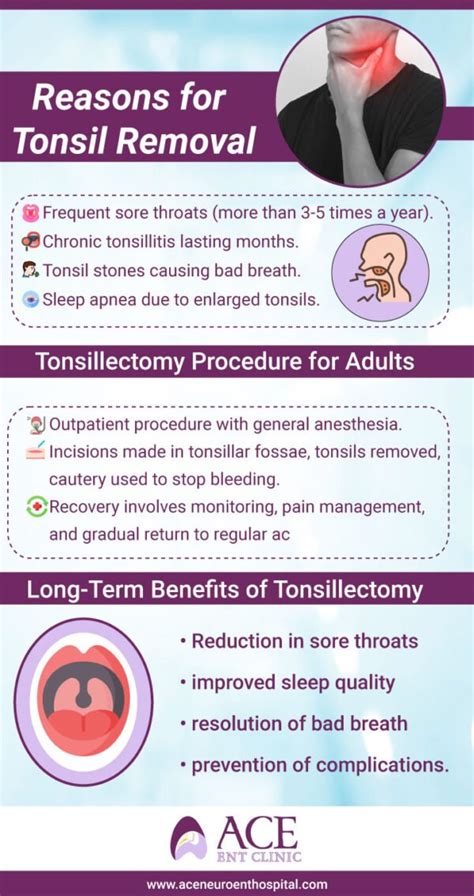 When Is Tonsil Surgery Necessary Exploring Adult Tonsillectomy