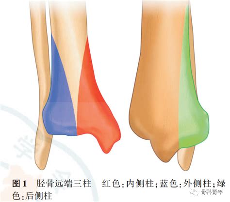 骨科基础介绍骨关节相关的7种三柱理论 好医术文章 好医术 赋能医生守护生命