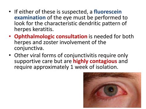 Diagnosis And Management Of Pediatric Conjunctivitis Ppt