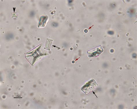 Calcium Crystals In Cat Urine At Jennifer Felder Blog