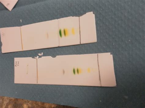 The Difference Between Paper Chromatography And Thin Layer