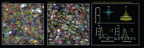 Primary Cells Heterogeneous Cells Prostate Cancer Livecyte