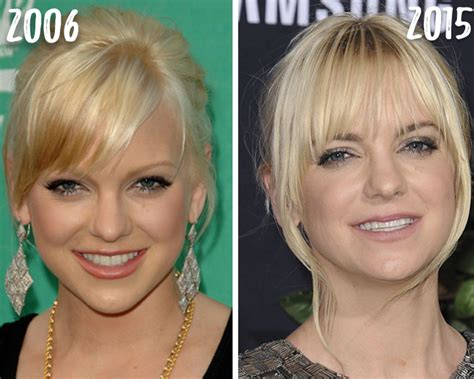 Anna Faris Plastic Surgery See How The Actress Has Transformed