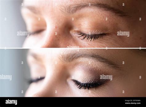 Woman Face Skin Make Up Comparing Before And After Stock Photo Alamy