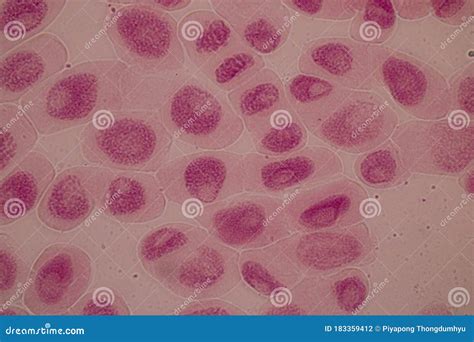 Mitosis Cell In The Root Tip Of Onion Under A Microscope Stock Photo Image Of Membrane