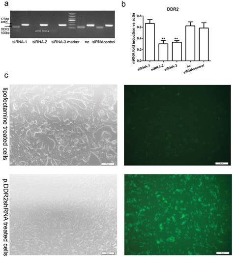 Screening Of Discoidin Domain Receptor 2 Ddr2 Sirna And Transfection Download Scientific