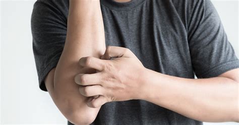 20대 이상 아토피피부염 환자 급증 올바른 피부 관리법은