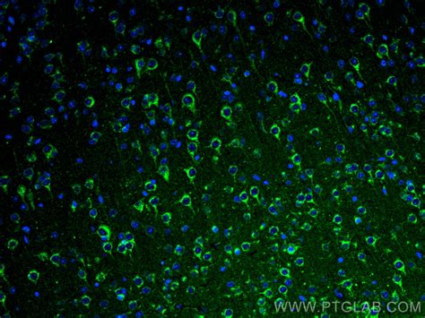 Sortilin Antibody 68007 1 Ig Proteintech