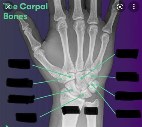 Pa Wrist Labeling Diagram Quizlet